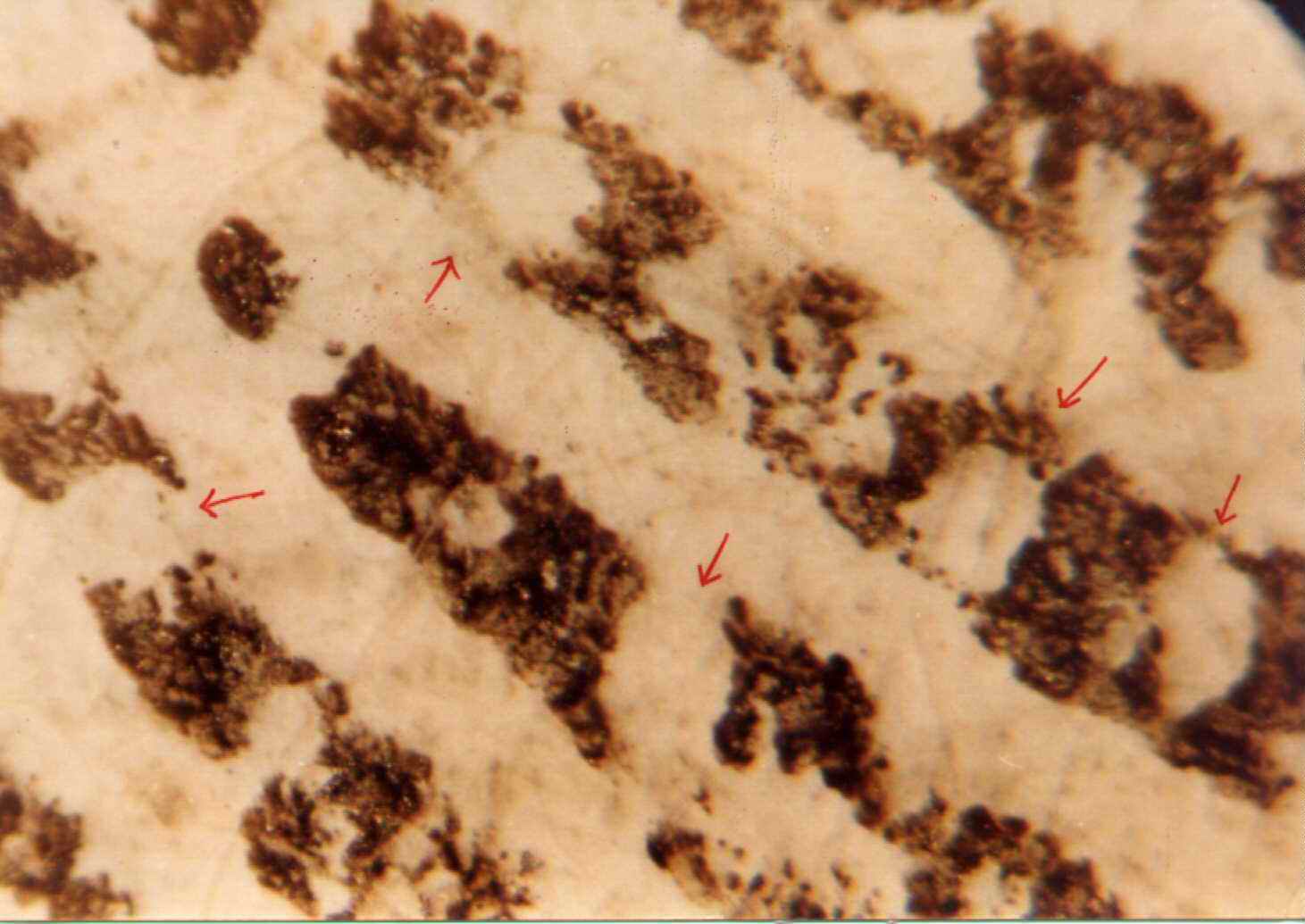 Paper 3: Poroscopy: A Method Of Personal Identification Revisited by ...