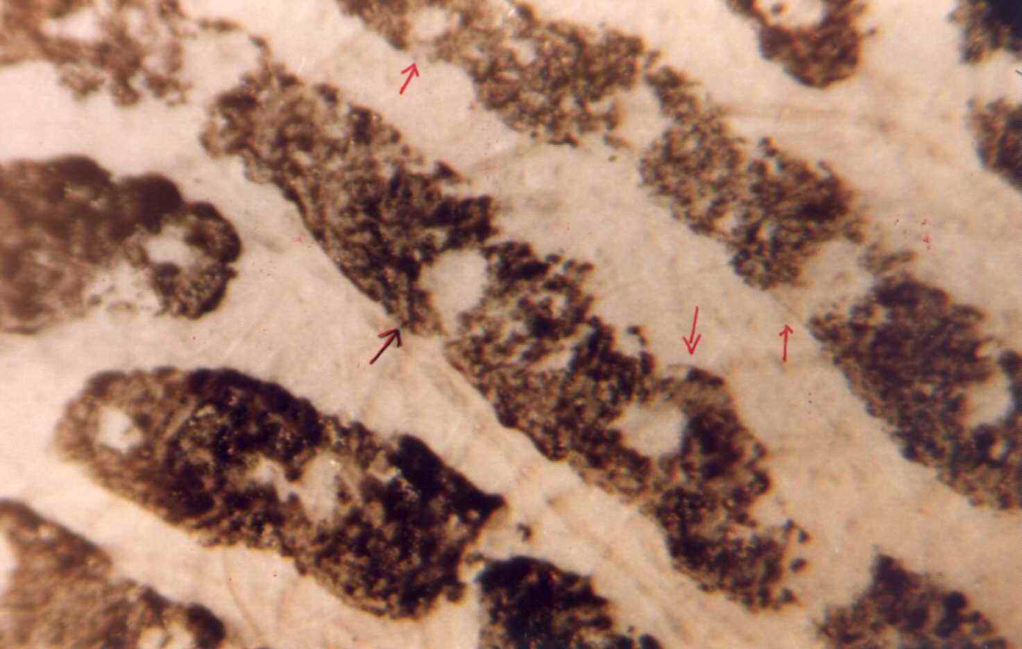 Paper 3: Poroscopy: A Method Of Personal Identification Revisited by ...